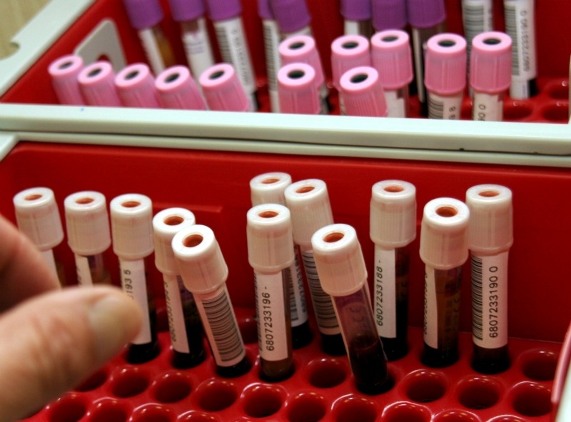 Older patients 'need routine blood testing' | Nursing Times