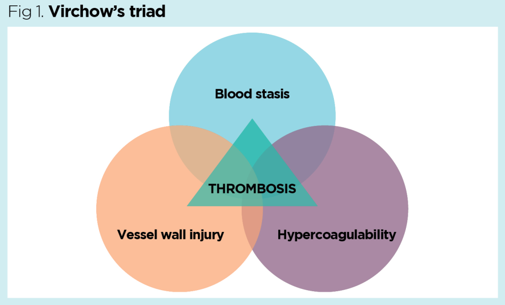 Virchows Triad Virchow Triad