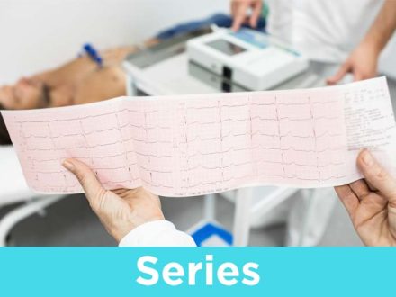 Skills update: electrocardiogram | Nursing Times