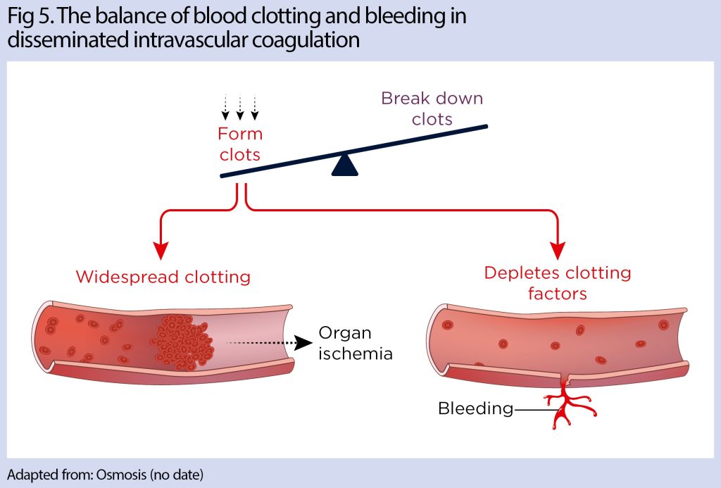 Coagulopathies: abnormal blood-clotting and bleeding disorders ...